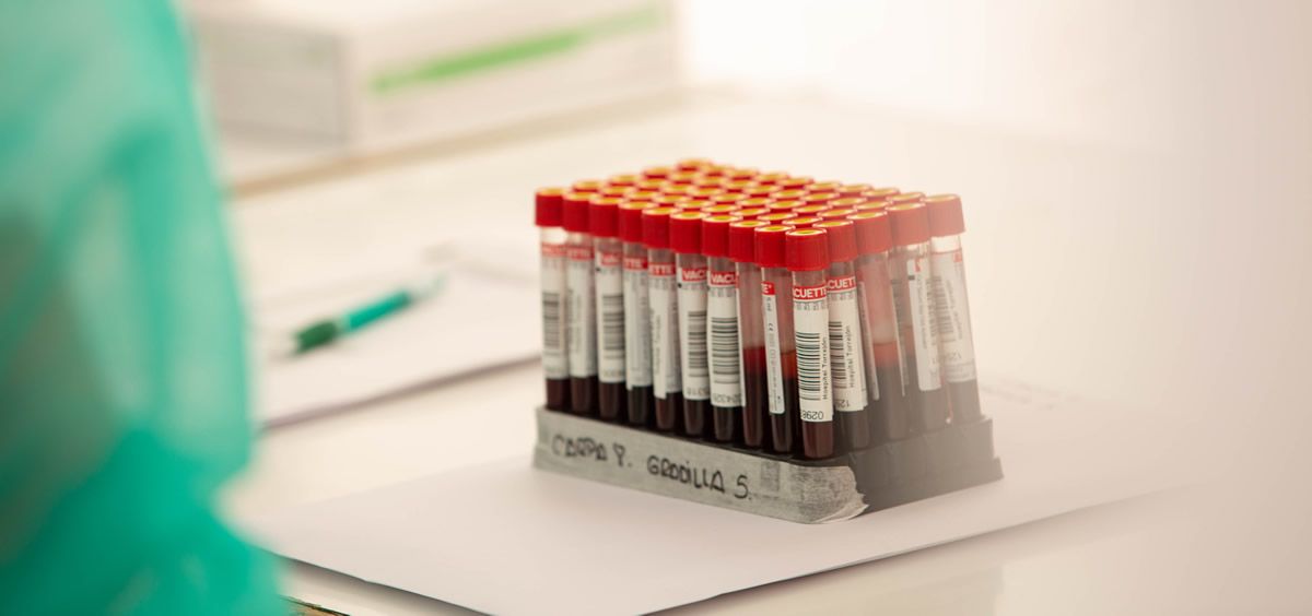Ribera Lab facilita el deporte seguro con pruebas Covid y control de ...