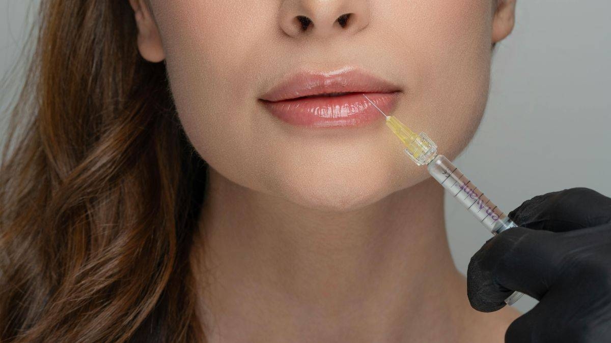 Las 6 claves que debes saber antes de hacerte un relleno de labios ...