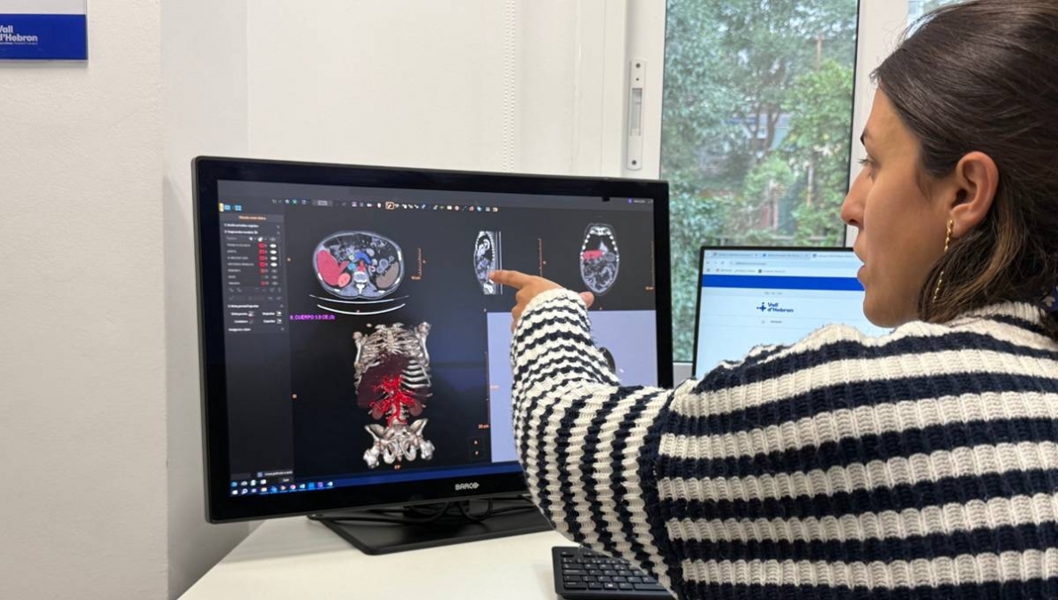 La nueva Unidad de Tecnologías 3D de Vall d’Hebron recibe la ...