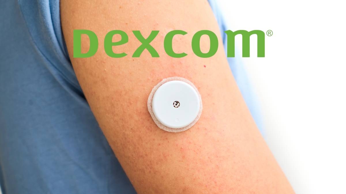 Dexcom alerta del robo y venta de sensores de glucosa G7 descartados ...